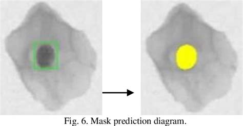 Figure 1 From Automated Segmentation Of Cervical Cell Images Using