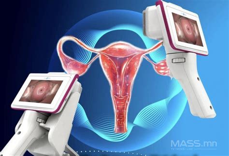 Б Атарцэцэг Таваас дээш жил жирэмснээс хамгаалах эм уух нь умайн хүзүүний хавдар үүсгэх хүчин