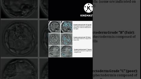 Embryo Icm And Trophectoderm Youtube