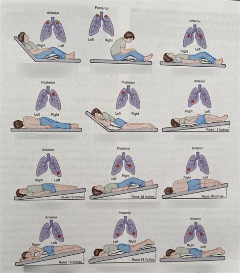 Ch 44 Part Postural Drainage Positions Diagram Quizlet