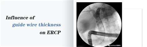 Influence Of Guide Wire Thickness On Ercp