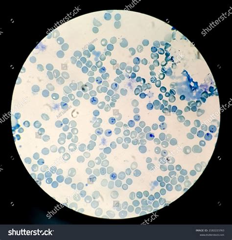 Reticulocyte Count Blood Smear Hematology Stock Photo Shutterstock