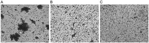 Interaction Of Biotinylated Aptamer Coated Streptavidin Paramagnetic