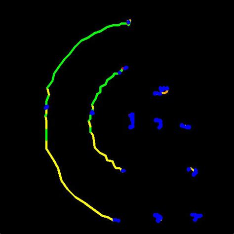 Motion Curve Shown Over Subject Performing Arm Abduction And Adduction Download Scientific