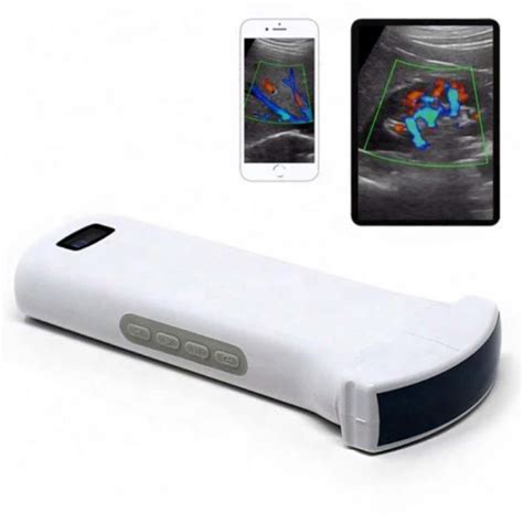 Convex Pregnancy Color Doppler Ultrasound Pocket 256 Elements