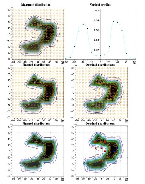 comparison of measured and calculated dose distributions using the 3