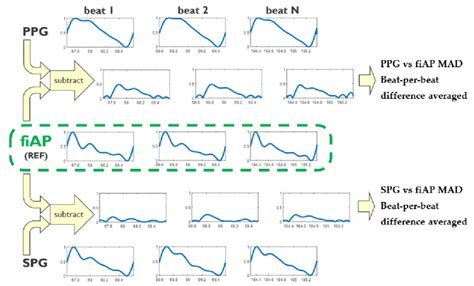 Comparison Of Ppg Top And Spg Bottom Waveform Morphologies With