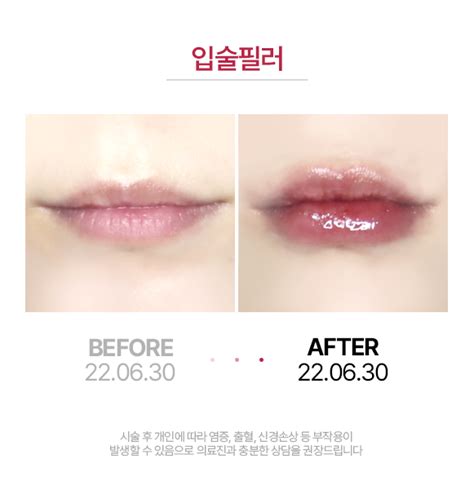 톤즈의원 브랜드소개