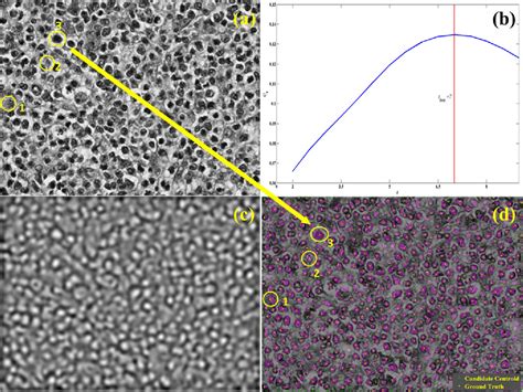 figure 1 from small blob identification in medical images using