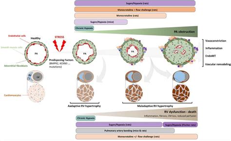 Pulmonary Arterial Hypertension Pah Models Creative Bioarray Creative Bioarray