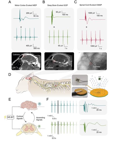 Wireless Neural Stimulation Through Endocisternal Interface In Sheep A Download Scientific