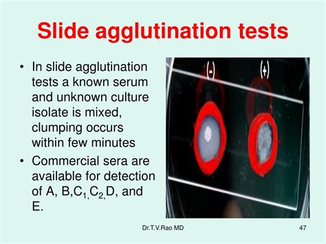 Ppt Salmonella Basics Powerpoint Presentation Free Download Id 2377118