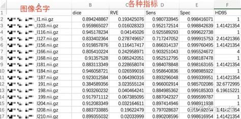 三行命令搞定nnunet V2训练及推理！（三） 知乎