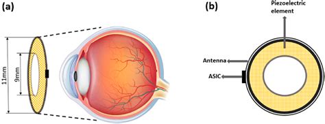 Figure 1 From Design And Simulation Of A Ring Transducer Array For