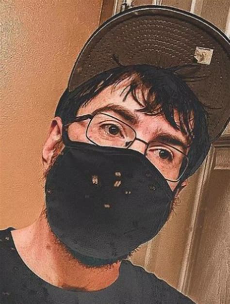 Man With The Worlds Smallest Penis Reveals Surprising Thing His