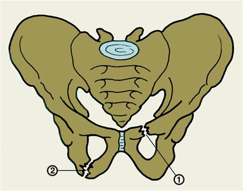 Таз Где Находится Фото – Telegraph