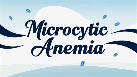Microcytic Anemia Types Diagnosis And Treatments