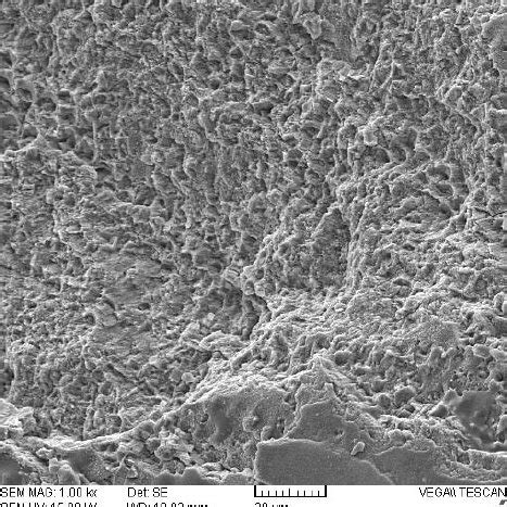 Enamel Surface After Conventional Acid Etching 1000 Download Scientific Diagram