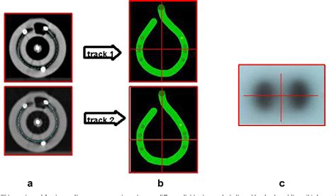 figure 1 from recommendations from gynaecological gyn gec estro