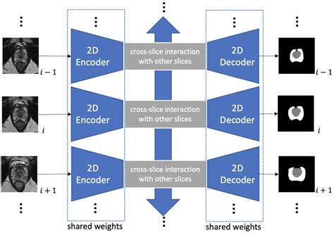 A A Conventional 2d Segmentation Network Inputs A Slice Of Interest