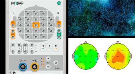 Successful Practitioner On Linkedin Qeeg Neuroguide Wineeg