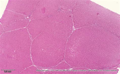 Low Magnification Image Illustrating The Lobular Structure Of The Liver