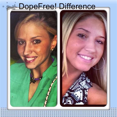Before And After Image Gallery Image Gallery