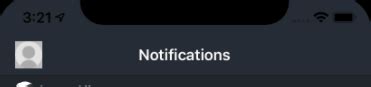 TopBar Custom Component Button Problem With Transparent Issue Wix React Native