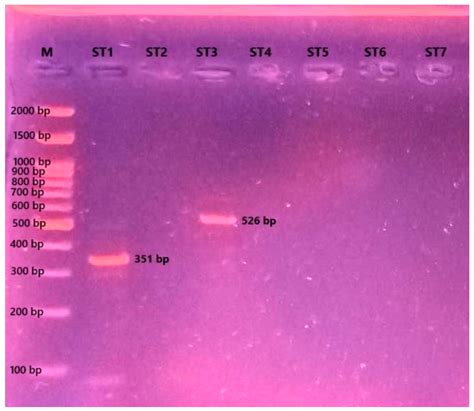 Antiprotozoal Effects Of Pediococcus Acidilactici Derived Postbiotic On
