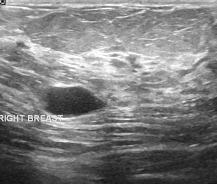 GitHub Fatmagamalgalal Brain Breast Tumor Classification And Segmentation