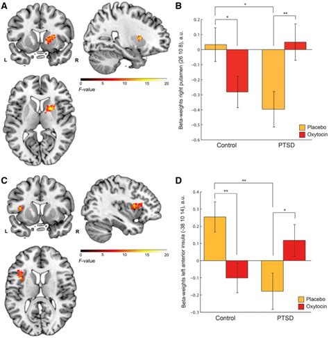 Intranasal Oxytocin Increases Neural Responses To Social Reward In Post
