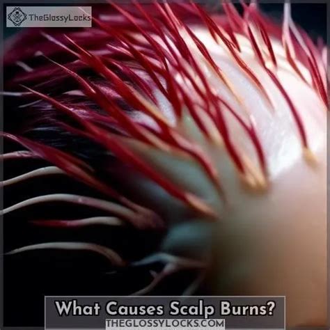 How To Treat Scabs On Scalp From Bleach Complete Guide To Heal Burns