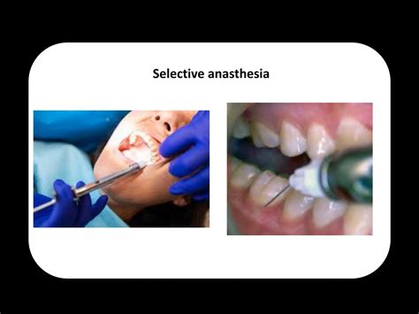 Endodontic Diagnosis First Part In Diagnosispptx Pptx