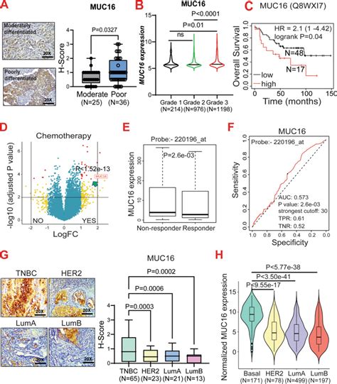 MUC Promotes Triple Negative Breast Cancer Lung Metastasis By Modulating RNA Binding Protein