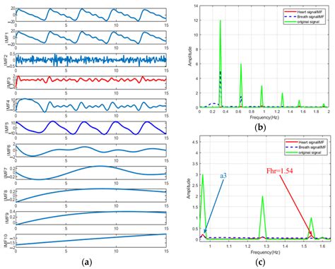 sensors free full text non contact detection of vital signs based