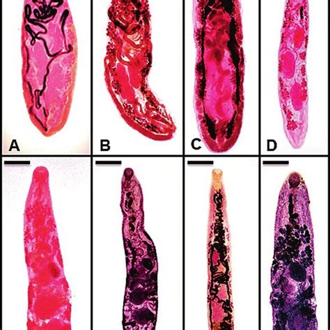 6 Examples Of Common North American Frog Bladder Flukes A