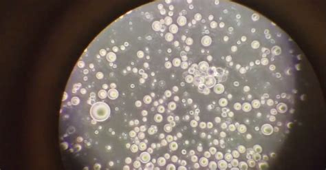 Mom Puts One Drop Of Breast Milk Under Microscope Then Catches Strange