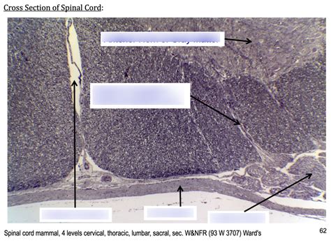 Lab A Cross Section Of Spinal Cord Diagram Quizlet