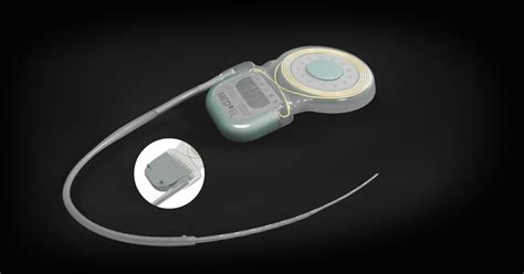 Cochlear Implants Sensorineural Hearing Loss Med El