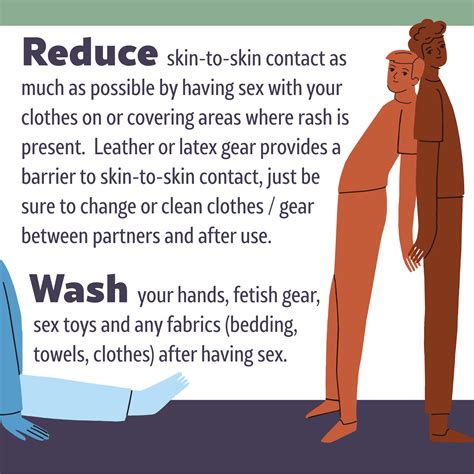 Mpox Slow The Spread Montana Public Health Institute