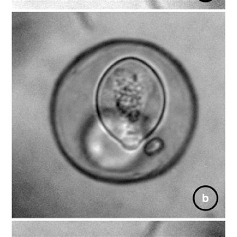 Isospora Belli Ooscysts In Stool Smear Preparations A Iodine Staining
