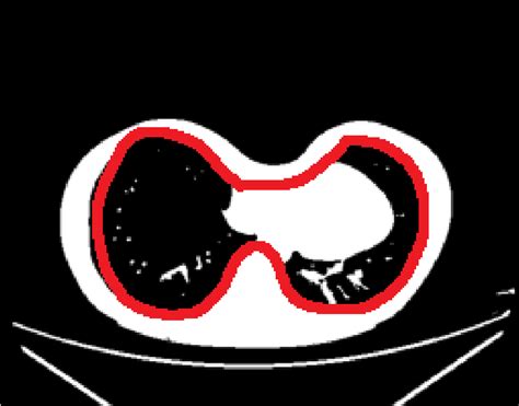 Python Calculate The Inner Contour Of A Computed Tomography Stack Overflow