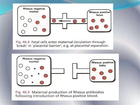 Rh Incompatibility Pptx