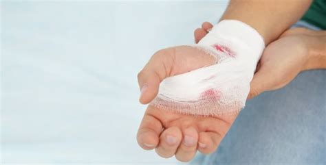 When Does A Cut Needs Stitches Walk In Urgent Care Clinic Near Me