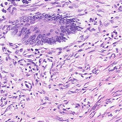 kalbedigitallab pathology nuclei segmentation classification at main