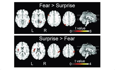 Significant Differences In The Activation Of Brain Regions During The Download Scientific