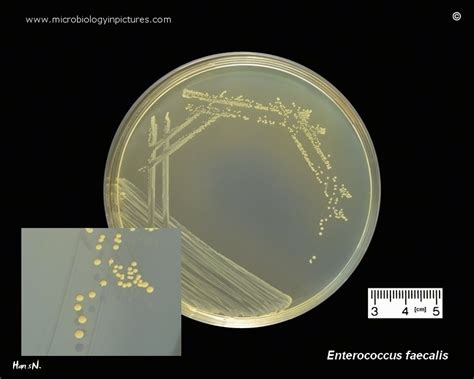 Enterococcus Faecalis Colony Morphology