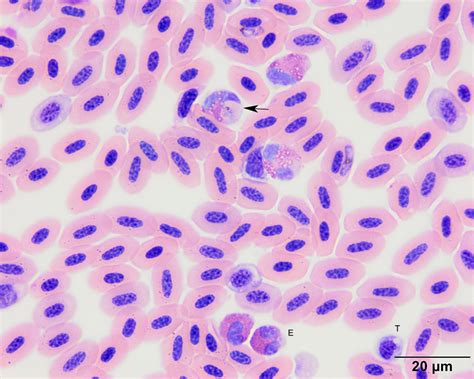 Parasite EClinpath