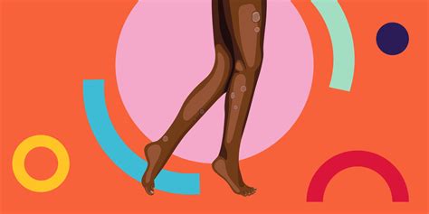 How Ringworm Affects Black Skin According To Dermatologists