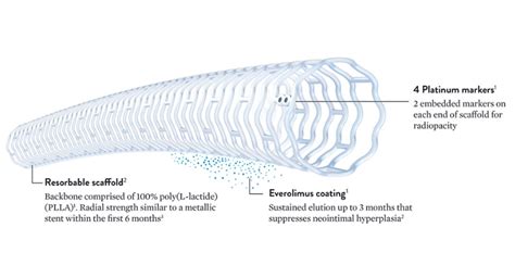 Abbotts Esprit Btk Dissolving Stent Earns Ce Mark